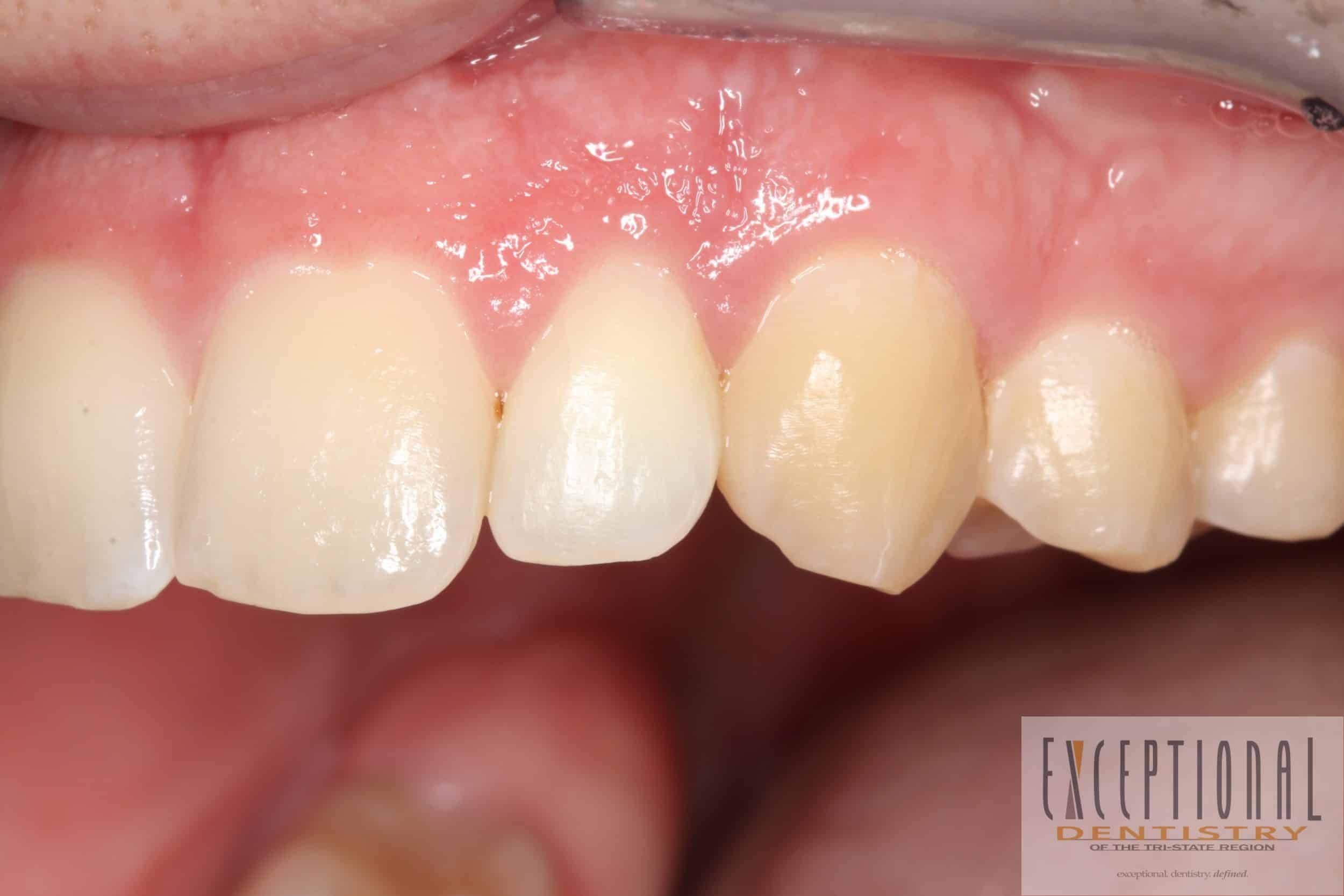 Gallery - Exceptional Dentistry - Dr. Ted Murray